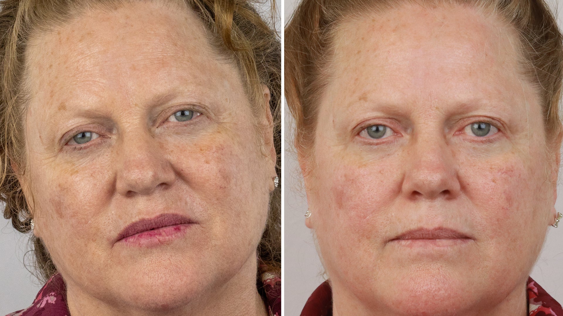 Total Glow Restore - Bakuchiol Skin Firming Wrinkle Cream - Revival ...